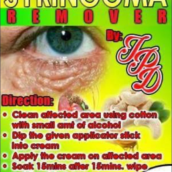 Syringoma | Skincare | Syringoma Cream Remove Syringoma 0 Effective ...